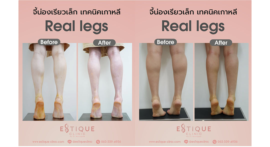 Real legs – คลินิกศัลยกรรมความงาม
